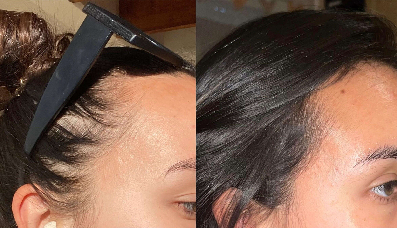 Shop for Burdock Root Hair Oil | Bur Bur – BUR BUR