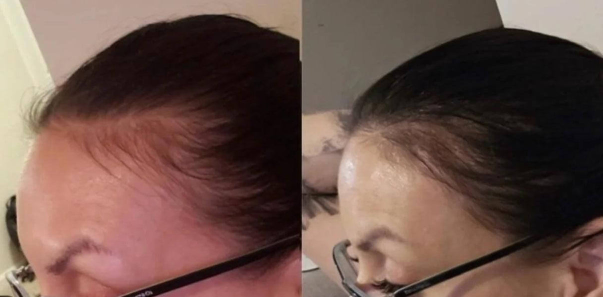 Shop for Burdock Root Hair Oil | Bur Bur – BUR BUR