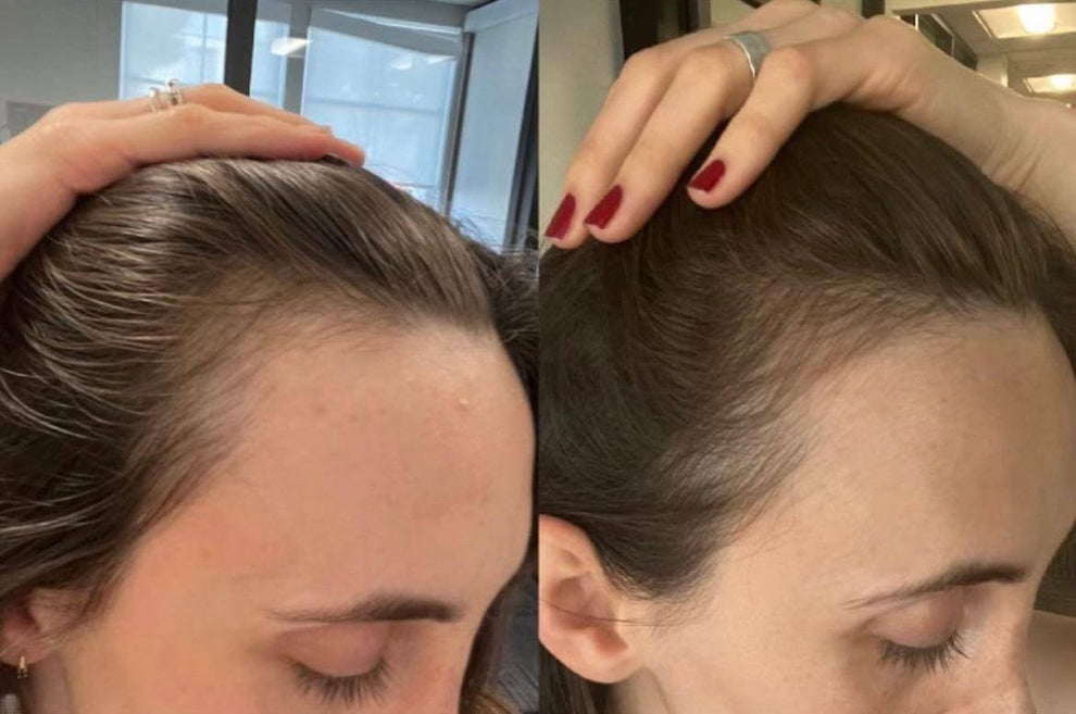 Shop for Burdock Root Hair Oil | Bur Bur – BUR BUR